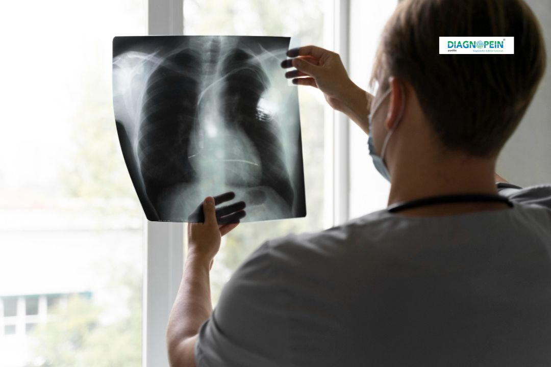 CT Chest Contrast Scan – Purpose, Procedure & Results Explained