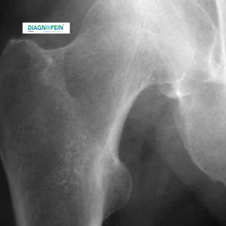 CT Femur Plain Scan – Detailed Imaging for Accurate Diagnosis