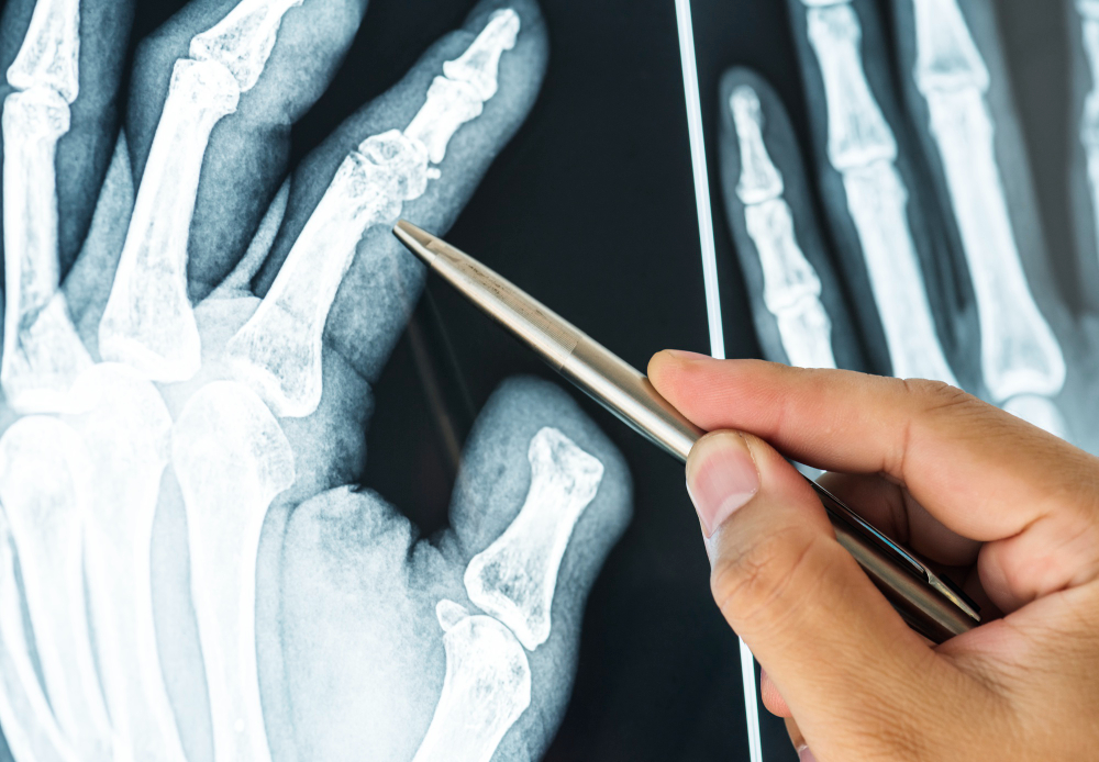 CT Hand Plain | Advanced Hand Bone CT Scan for Fractures & Joint Issues