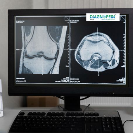 CT LT Forearm Scan – Purpose, Preparation, and Procedure Explained