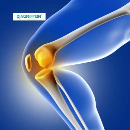 CT LT Knee Joint Scan | Purpose, Procedure & Benefits