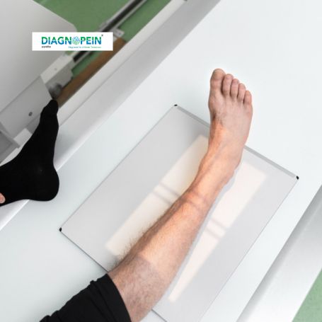 CT Left Leg (Plain) Scan – Purpose, Procedure, and Benefits