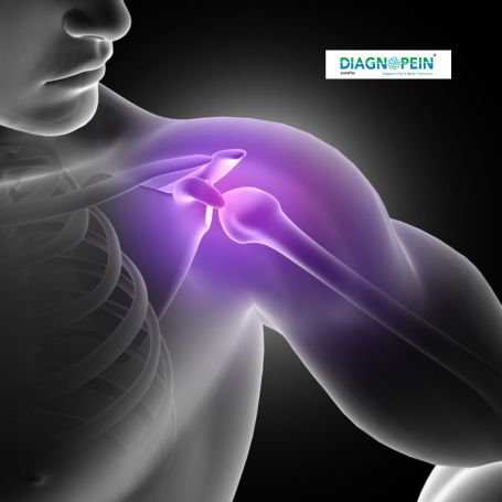 CT LT Shoulder Joint (Plain) Scan – Purpose, Procedure & Cost