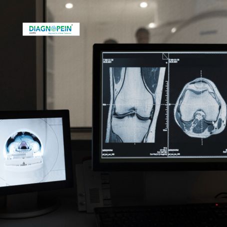 CT RT Ankle Joint Scan – Detailed Right Ankle Imaging Test | Fast ...