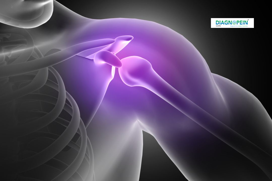 CT Right Elbow Joint – Scan, Indications, and Uses