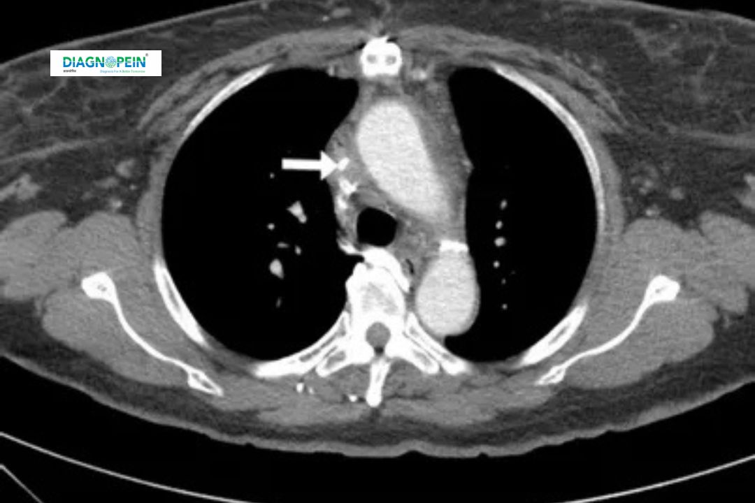 CT Scan Charges with Contrast in India 2025 – Full Cost Guide