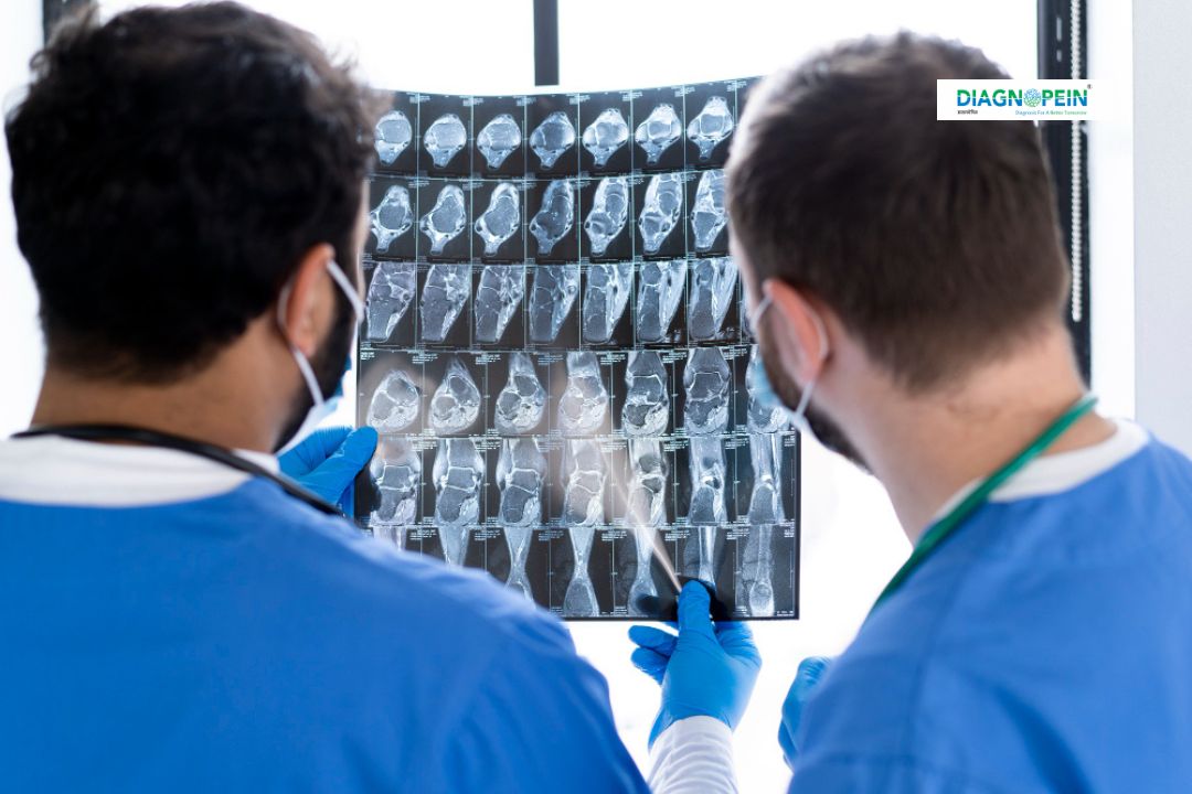 CT Upper Limb Angiography (CT Upper Limb Angio) – Accurate Vascular ...