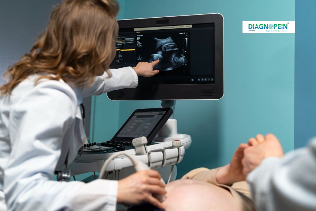 Echo Doppler Test | Heart Function & Blood Flow Analysis | Diagnopein