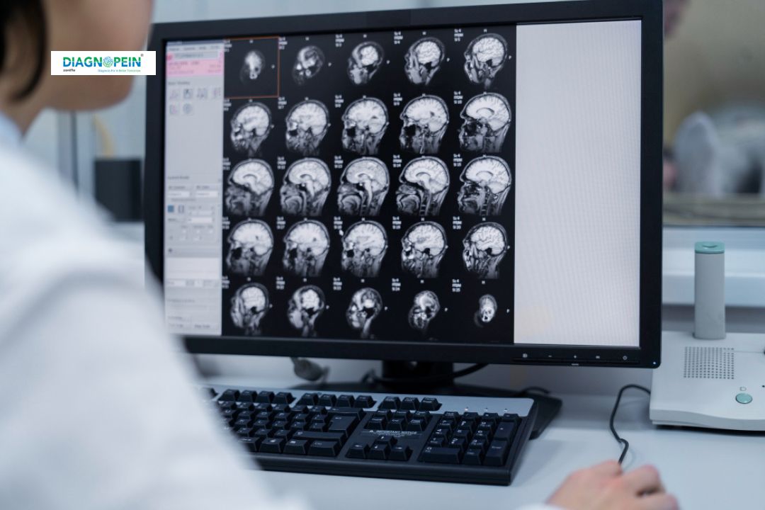 MRI Brain Angio & Neck Angio Scan | Magnetic Resonance Angiography for ...