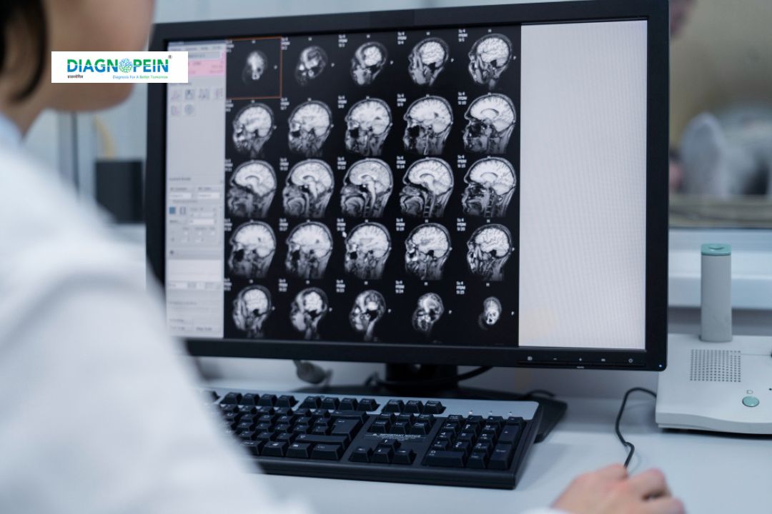 MRI Head/Brain – Without Contrast with Sialography | Accurate Brain ...