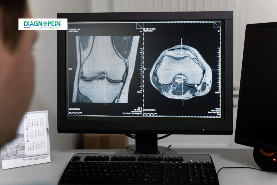 MRI Hip with Contrast and Sialography | Diagnostic Imaging & Early ...