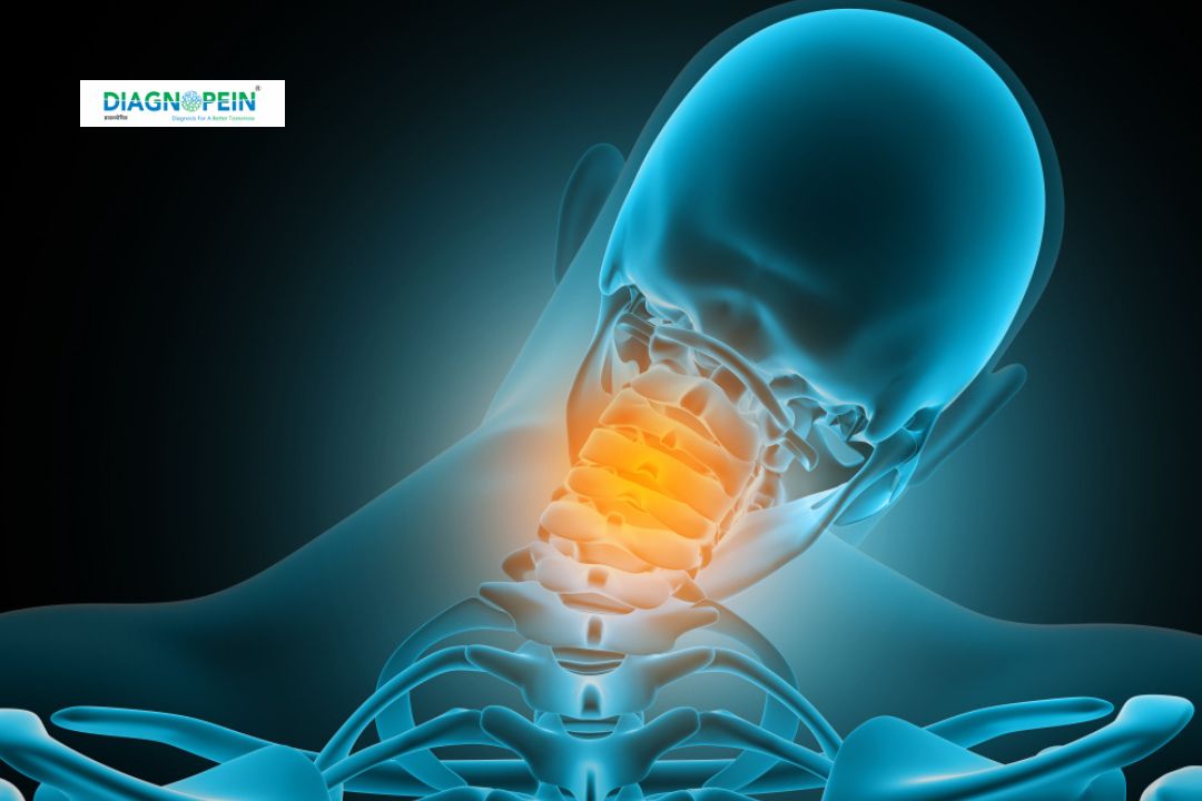 MRI Neck Scan Karad Without Contrast | Safe Non-Contrast Cervical Spine ...