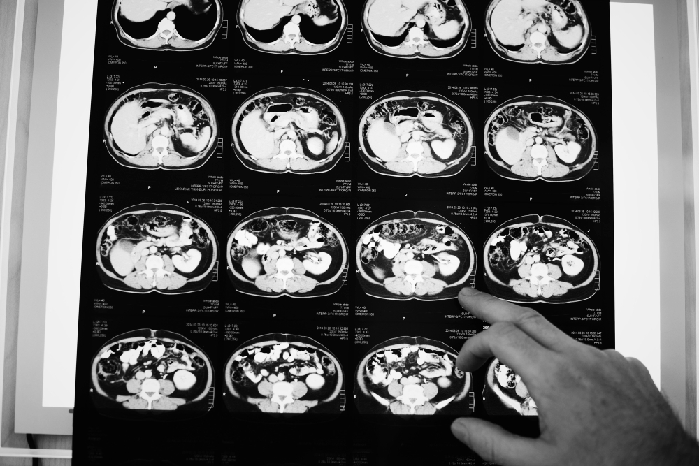 MRI Pelvis with Contrast in Karad | Affordable Diagnostic Center