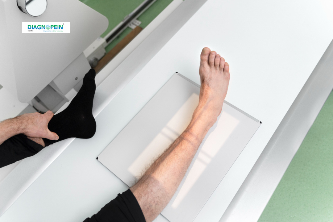 MRI Thigh Scan in Karad | Affordable 1.5 Tesla MRI for Thigh Pain ...