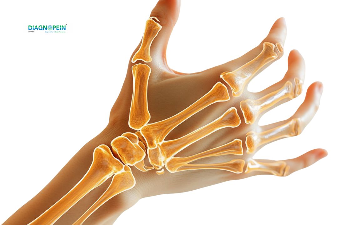 MRI Wrist Single Joint - Without Contrast | MRI Wrist Scan in Karad ...