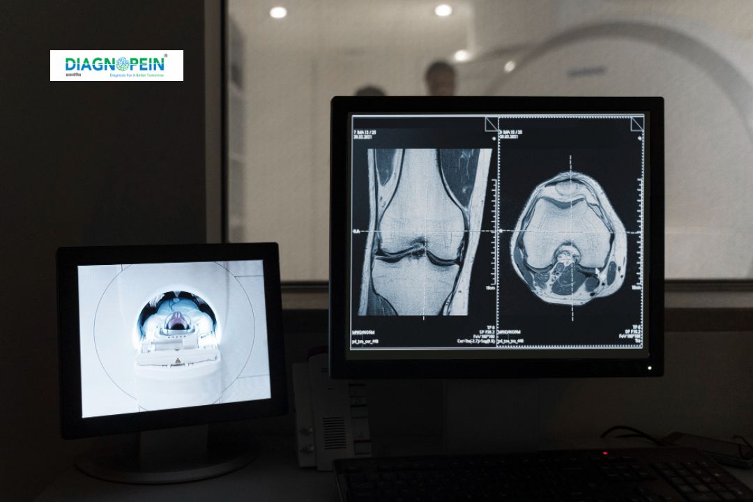 MRI Knee Both Joints with Contrast with Sialography | Advanced Imaging ...