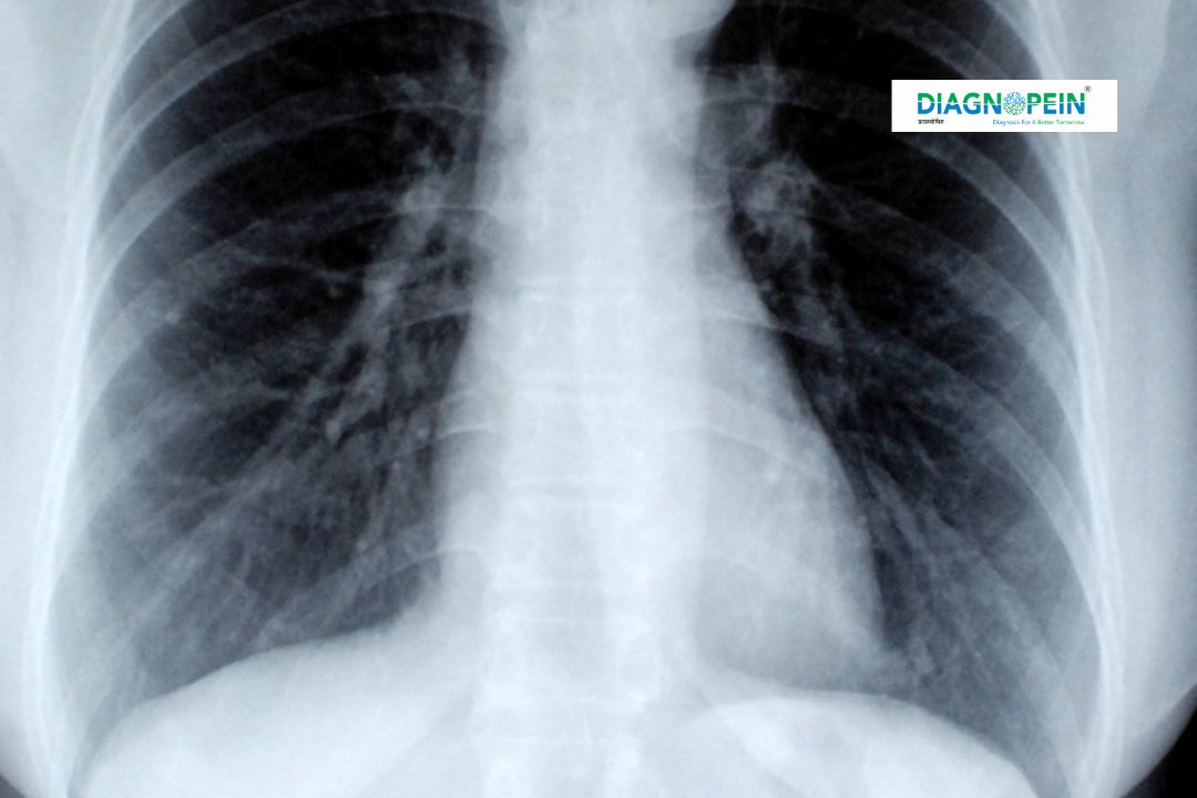 Oblique View X-Ray in Karad | SmartView Oblique Karad | Accurate ...