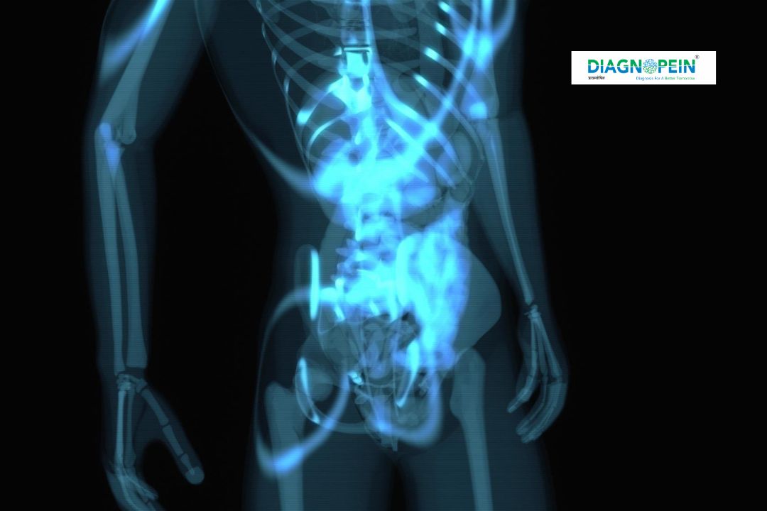 Pelvis Lat. View X-Ray in Karad – Overview, Procedure & Benefits ...