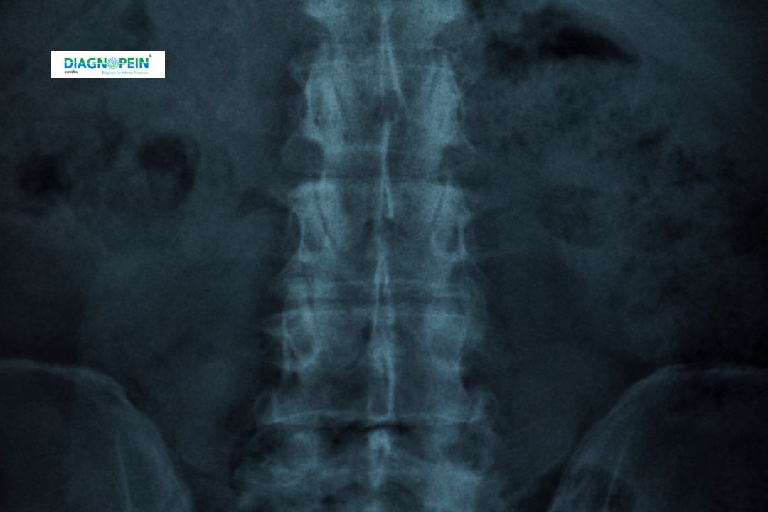 PNS Plain Scan in Karad | Best PNS X-Ray | Affordable Sinus Diagnosis