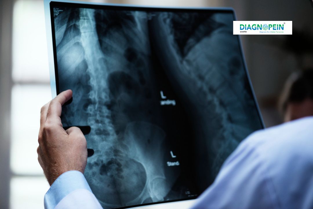 Pelvis AP (One Film) X-Ray in Karad | OrthoPelvis View | Diagnopein