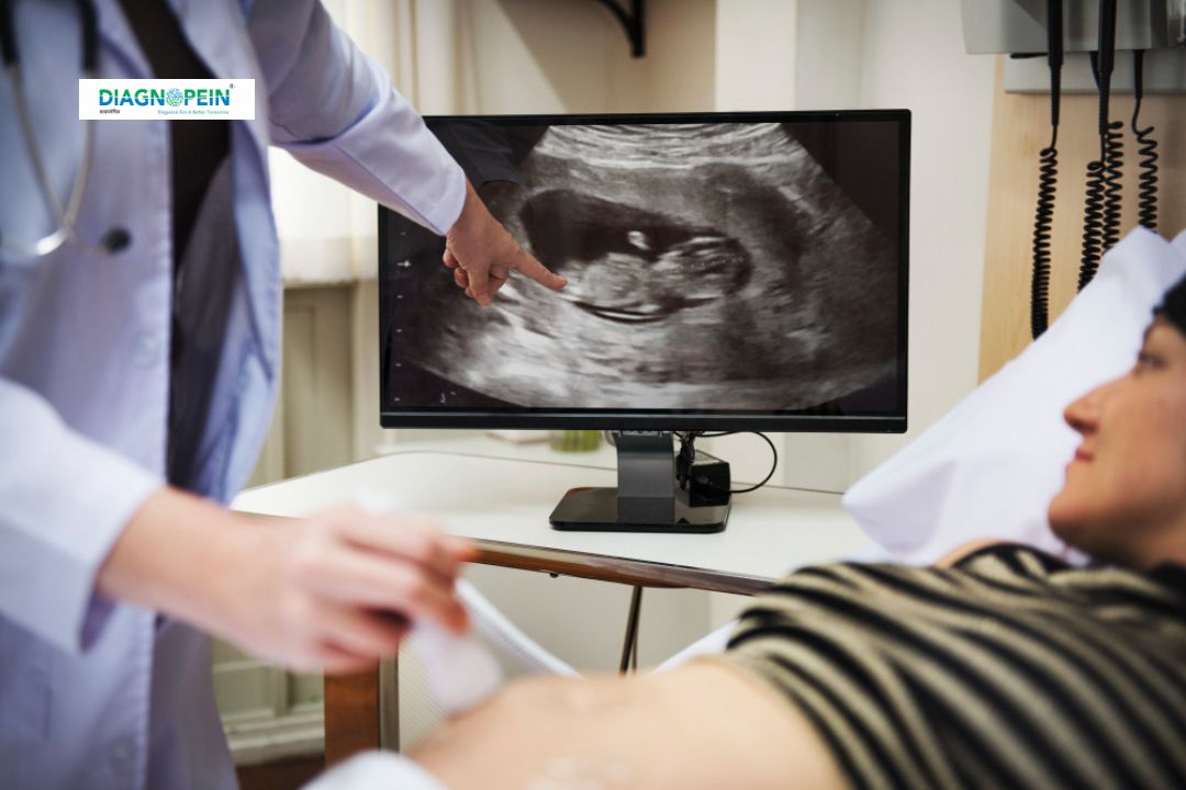 USG Anomaly Scan in Pregnancy | Fetal Level 2 Ultrasound Test – Early ...