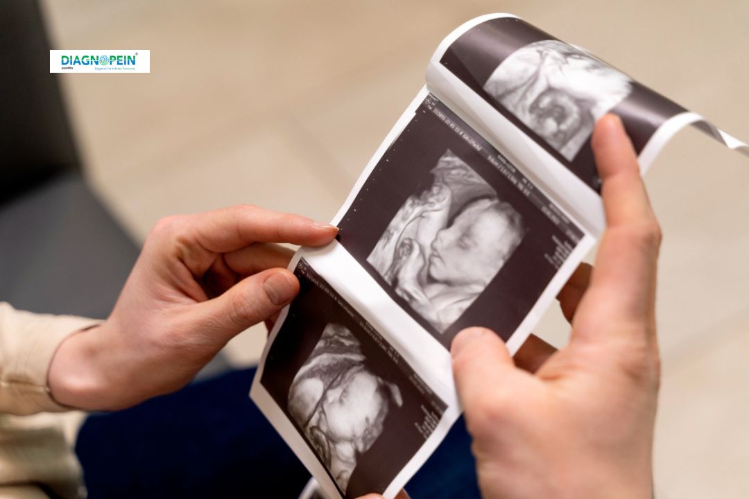 USG Fetal Echo (Twins Study) in Karad | Advanced Fetal Echocardiography ...