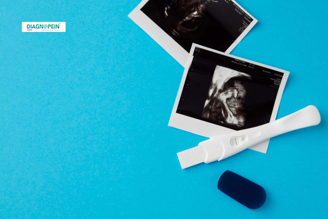 USG NT NB Early Anomaly Scan – Nuchal Translucency & Nasal Bone Test ...