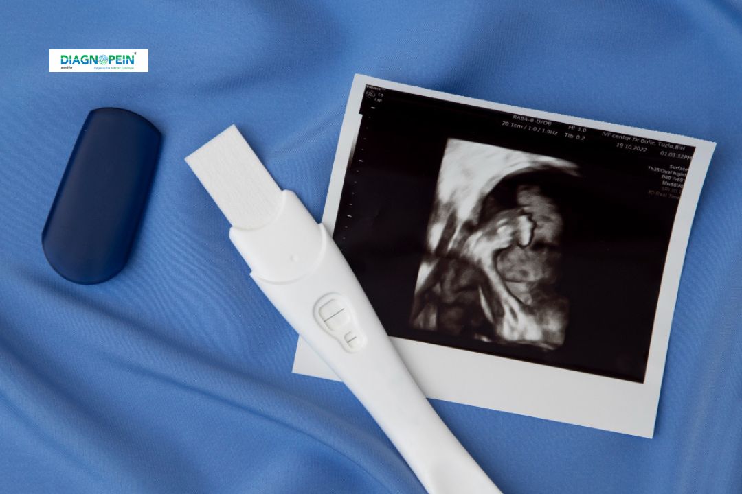 USG Pregnancy Anomaly Study (N/A) | Detailed Fetal Scan & Prenatal ...