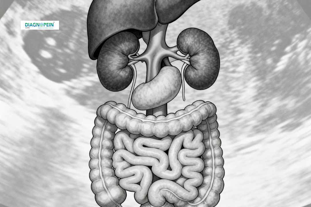 USG Whole Abdomen in Karad | Affordable Abdomen Ultrasound at Diagnopain