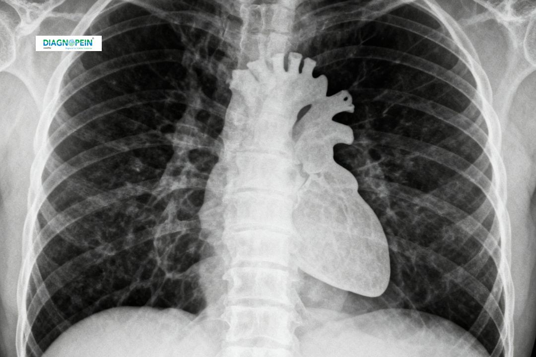 X-Ray Chest AP View in Karad | Diagnopein Advanced Diagnostic Imaging