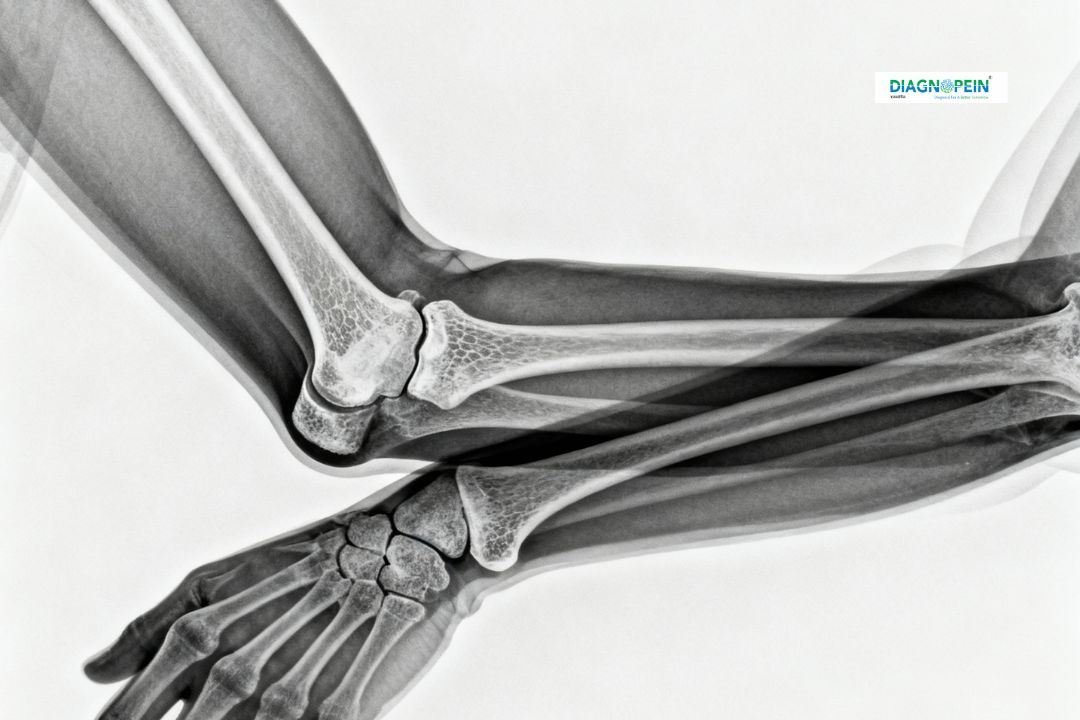 X-Ray Forearm AP/LAT in Karad | Diagnopein – Accurate Digital X-Ray ...