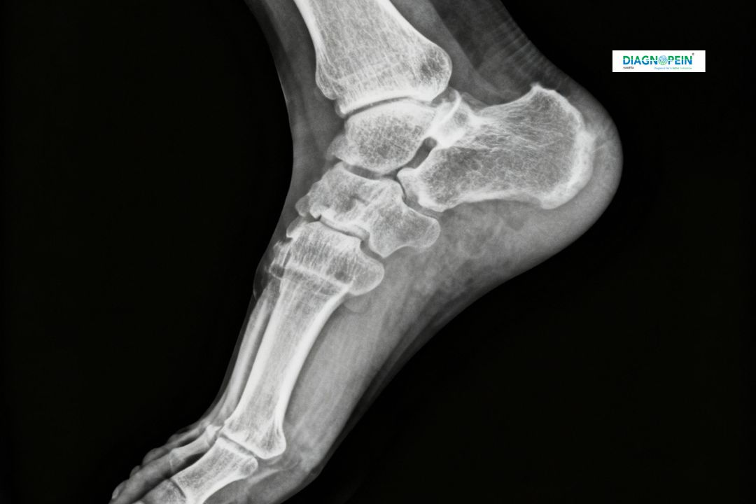 X-Ray Right Oblique View in Karad | Diagnopein Diagnostic Center