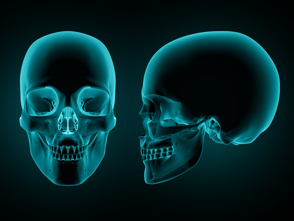 X-Ray Skull AP in Karad | Diagnopein Diagnostic Center