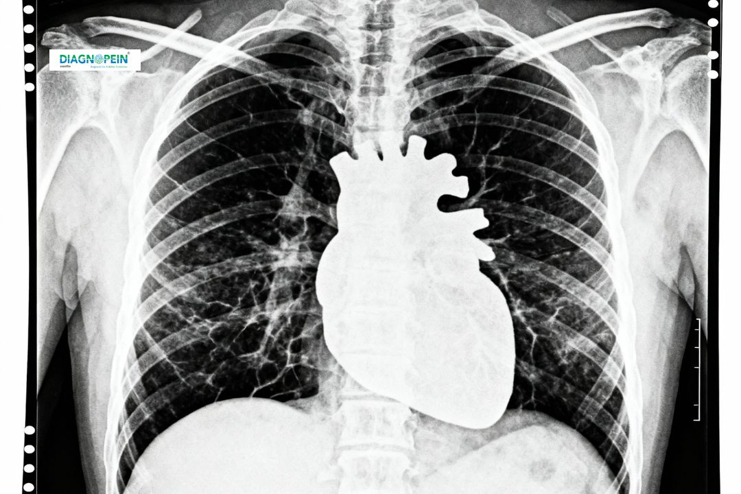 X-Ray Chest PA/AP/Oblique View (One Film) in Karad | Diagnopein Radiology