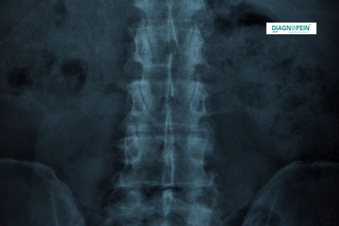 X-Ray Both Hip Joints AP View in Karad | Diagnopein Radiology Center