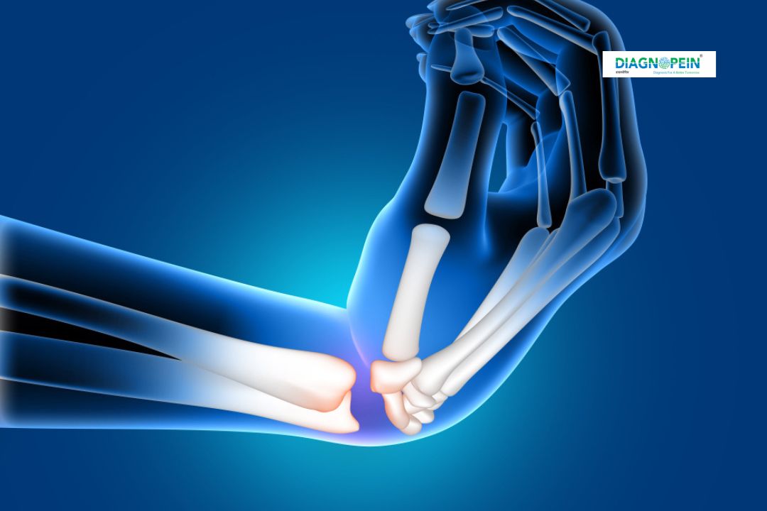 X-Ray Both Knee Joint AP/LAT in Karad | Diagnopein Advanced Digital Imaging
