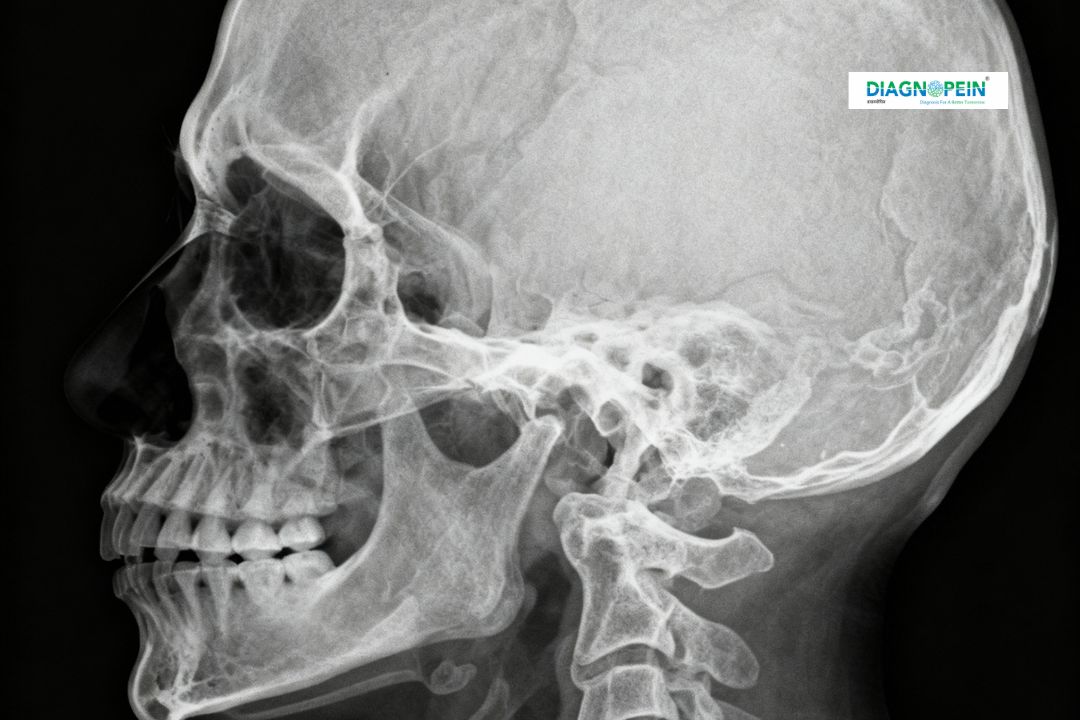 X-Ray Cephalogram (Lateral View) in karad | Cephalometric X-Ray at ...