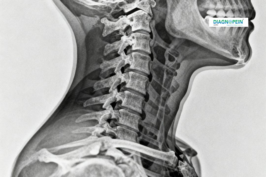 X-Ray Cervical Spine AP/LAT in Karad | Diagnopein Digital Diagnostic Center