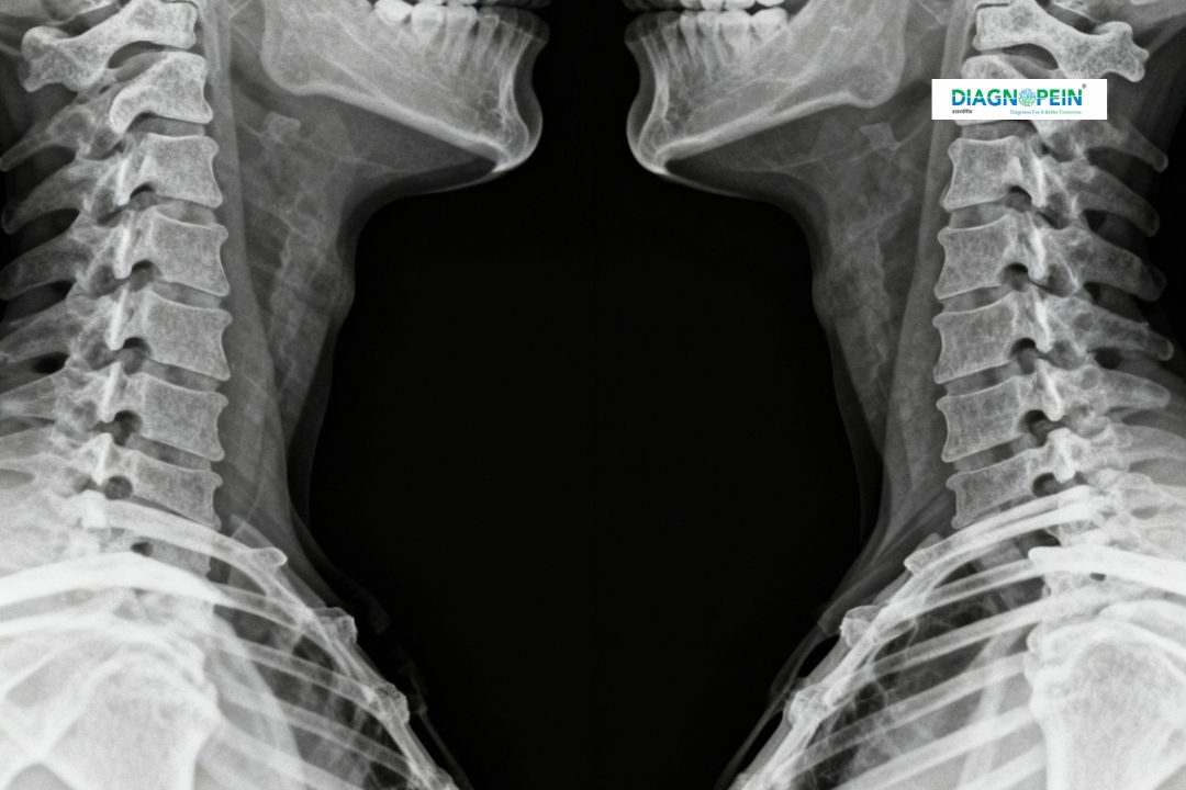 X-Ray Cervico-Thoracic Spine AP/Lateral View in Karad | Diagnopein ...
