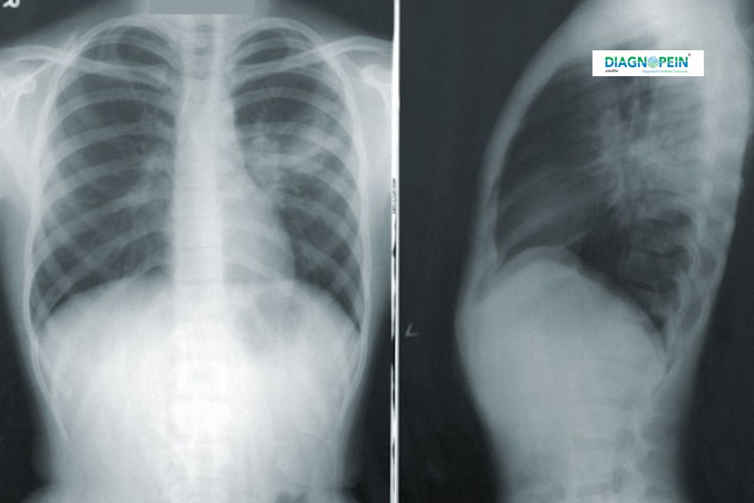 X-Ray Face AP / LAT in Karad | Facial Bone X-Ray Test at Diagnopein