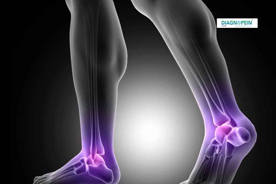X-Ray Heel Lateral View in Karad | Diagnopein Diagnostic Center
