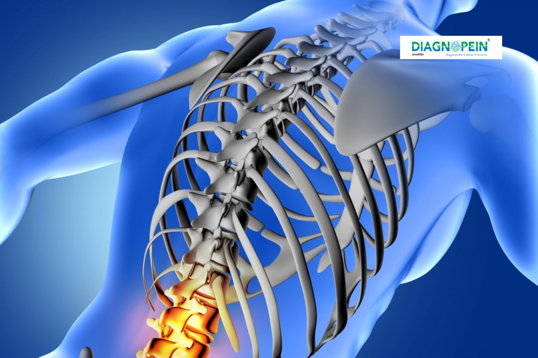 X-Ray Lumbar Spine Lateral View in Karad | Affordable Spine X-Ray Test ...