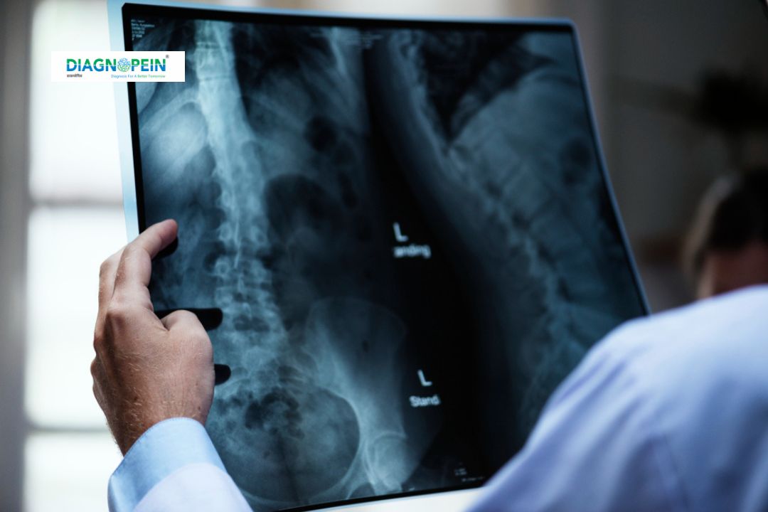 X-Ray Lumbo Sacral Flexion in Karad | Lumbar Spine X-Ray Test at Diagnopein