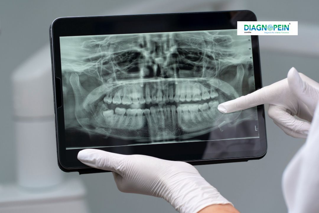 X-Ray Mandible AP in Karad | Digital Jaw X-Ray Test at Diagnopein