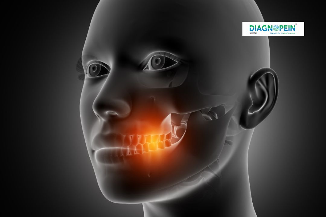 X-Ray Mandible in Karad | Accurate Jaw X-Ray Test at Diagnopein
