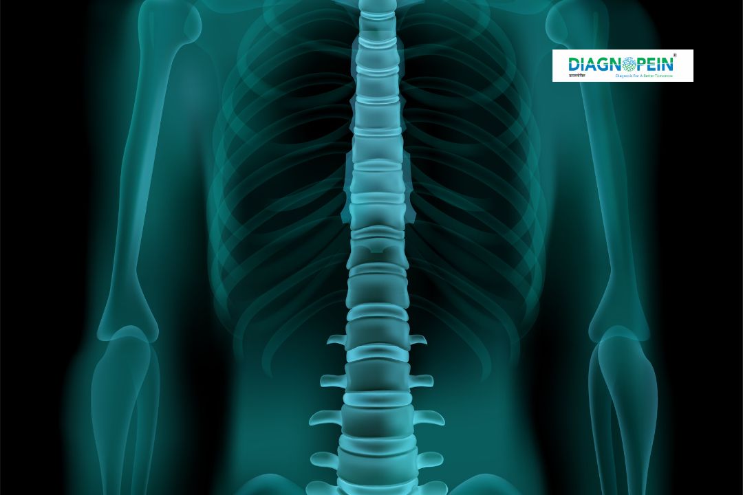 X-Ray Neck Lateral View in Karad | Diagnostic Neck Imaging at Diagnopein