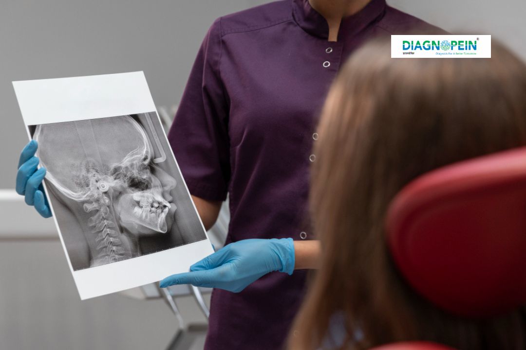 X-Ray OPG and Cephalogram in Karad | Digital Dental Imaging at Diagnopein