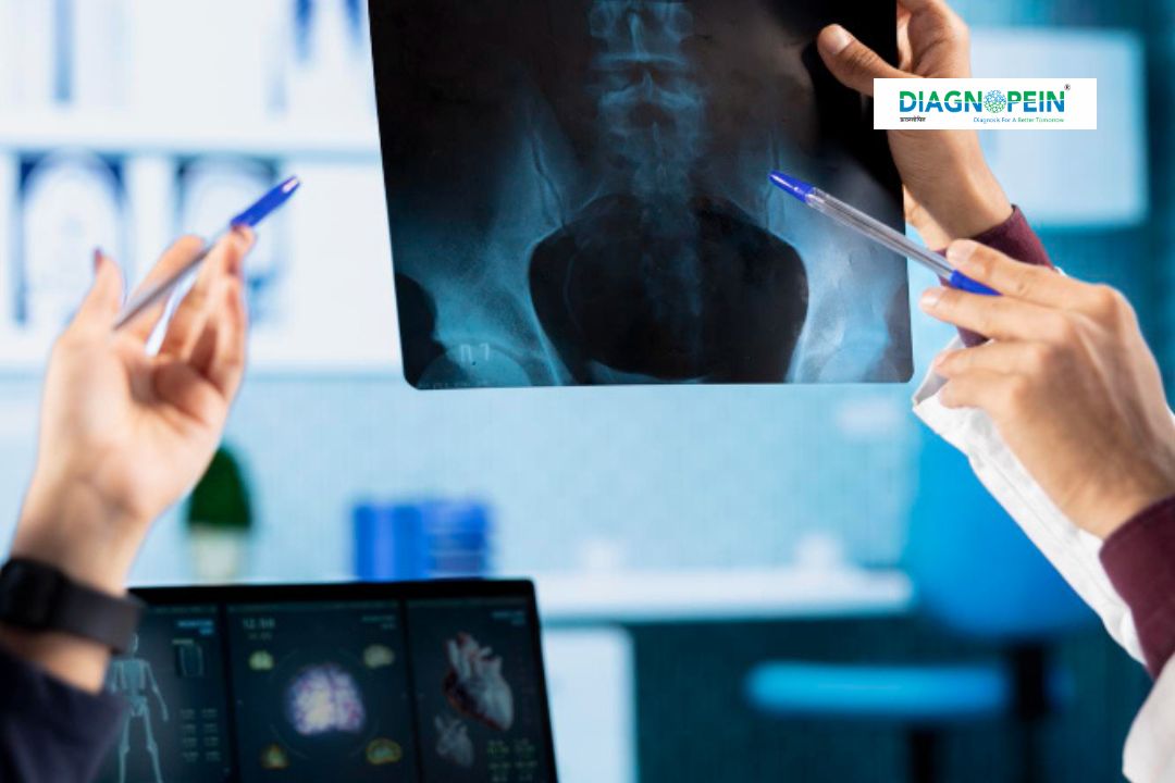 X-RAY PCB Inspection Karad | PCB X-RAY Testing & Repair Services ...