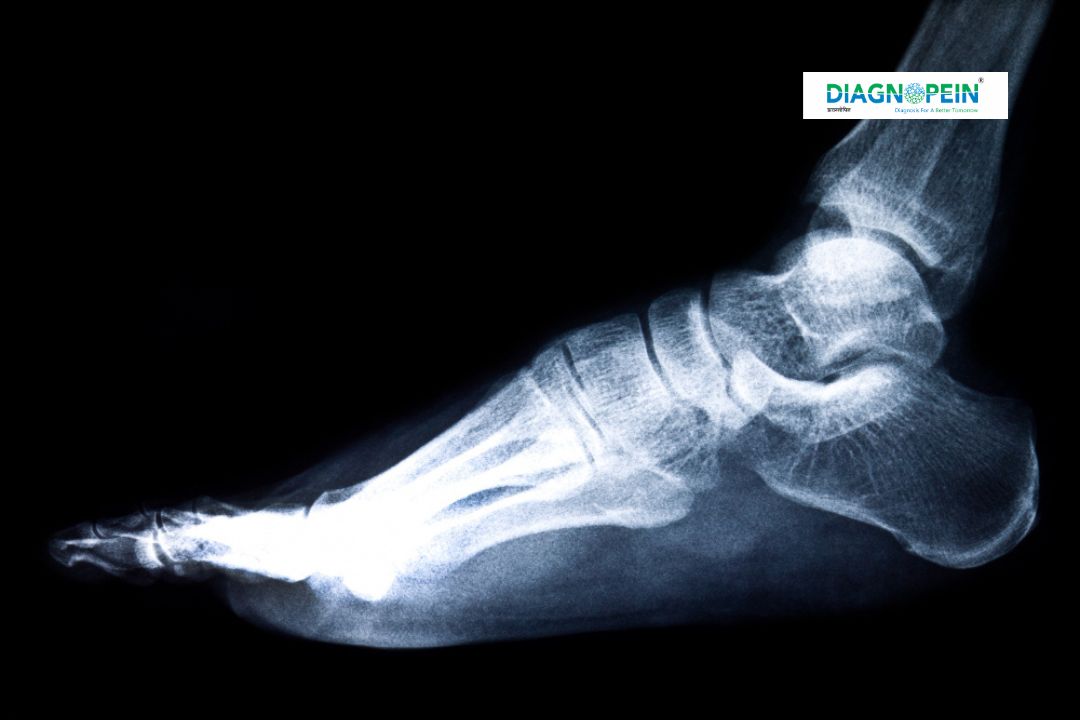 X-Ray Right Foot AP/LAT in Karad | Accurate Foot Bone Imaging – Diagnopein