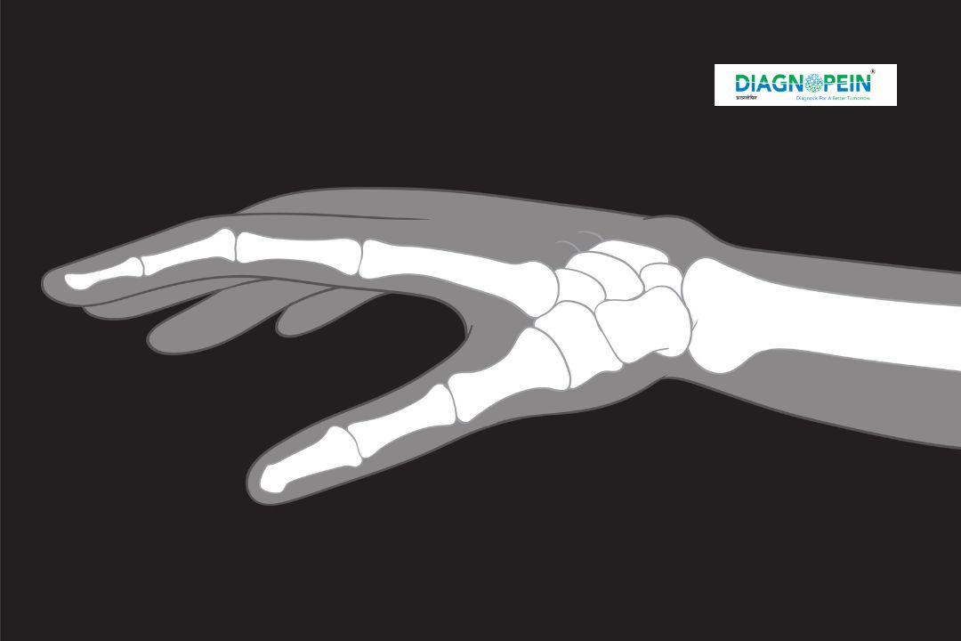 X-Ray Right Hand AP/Oblique in Karad | Accurate Imaging at Diagnopein